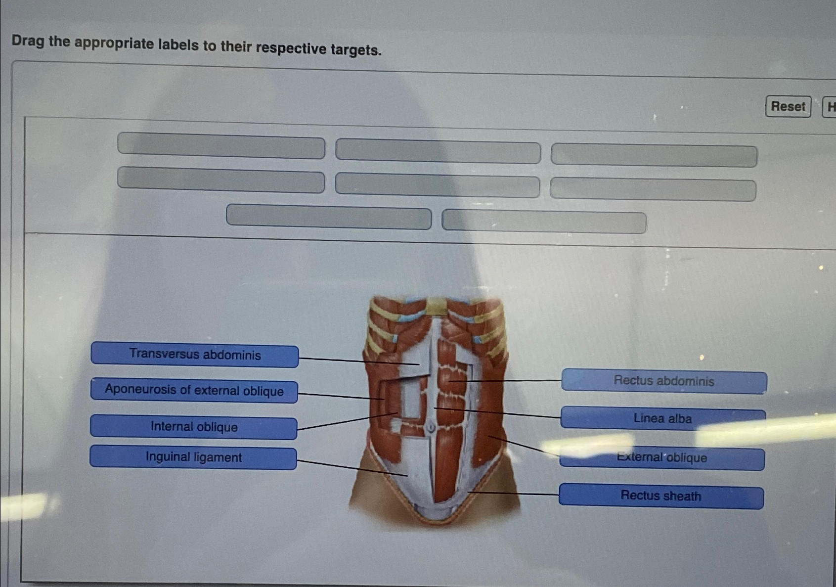 Solved Drag the appropriate labels to their respective | Chegg.com