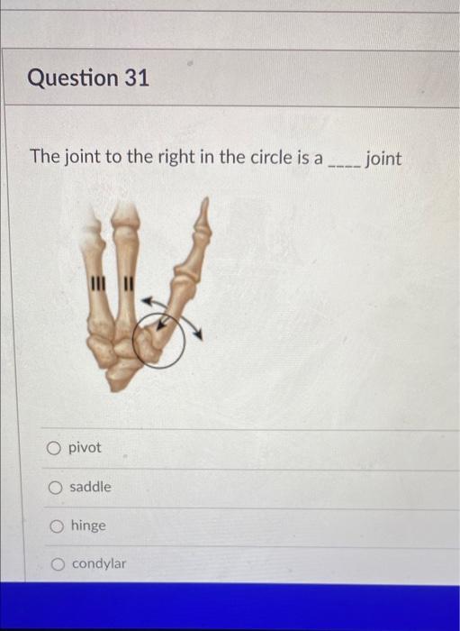 Solved Question 31 The joint to the right in the circle is a | Chegg.com