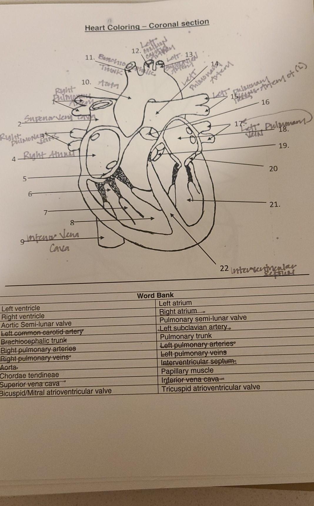 Solved gulunan en of (L) Heart Coloring - Coronal section | Chegg.com