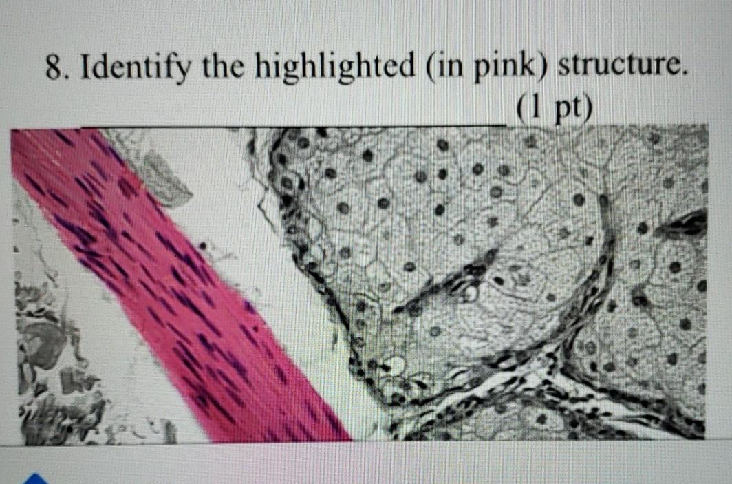 Solved 8. Identify the highlighted (in pink) structure. (1 | Chegg.com