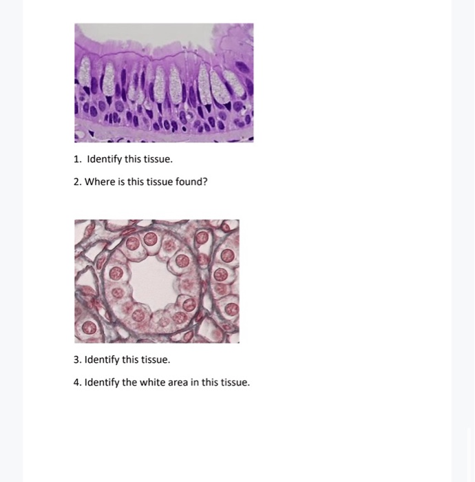 Solved 1 Identify This Tissue 2 Where Is This Tissue Chegg