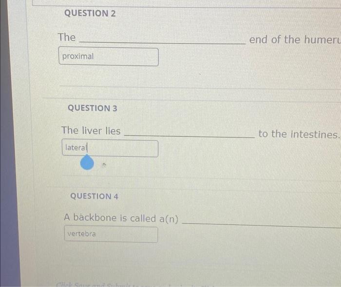 Solved QUESTION 2 The proximal QUESTION 3 The liver lies | Chegg.com