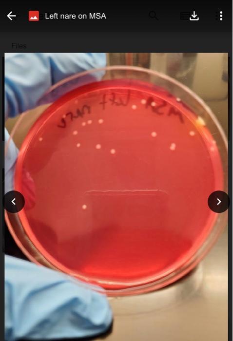 Solved What is the probably gram morphology for each colony | Chegg.com