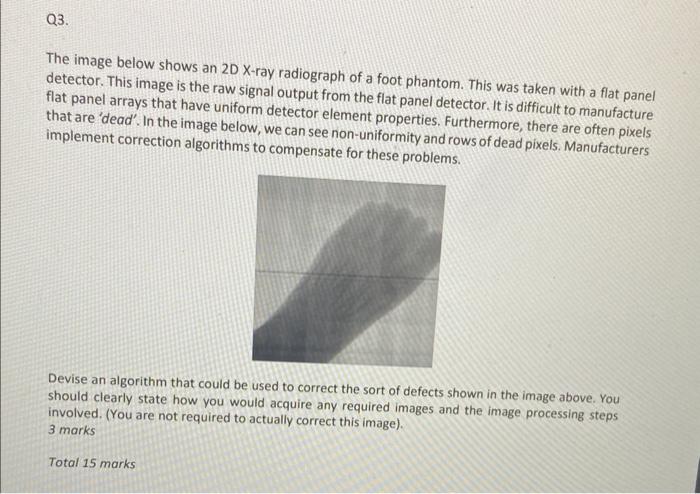 Solved The image below shows an 2D X-ray radiograph of a | Chegg.com