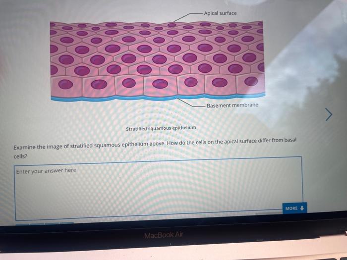 Solved Examine the image of stratified squamous epithelium | Chegg.com