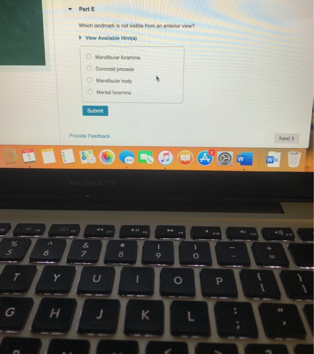 Solved Part E Which landmark is not visible from an anterior | Chegg.com