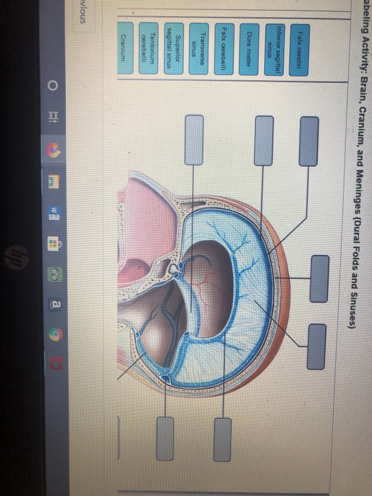Solved abeling Activity: Brain, Cranium, and Meninges (Dural | Chegg.com