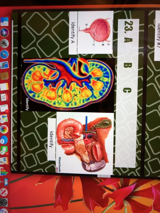 Solved Tuentity #/ 23. A B C Identify A Heartweb Identify | Chegg.com