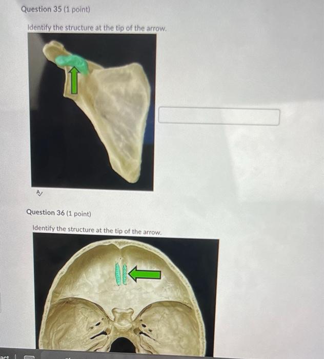 Solved Idanbicu. the Identify the bone at the tip of the | Chegg.com