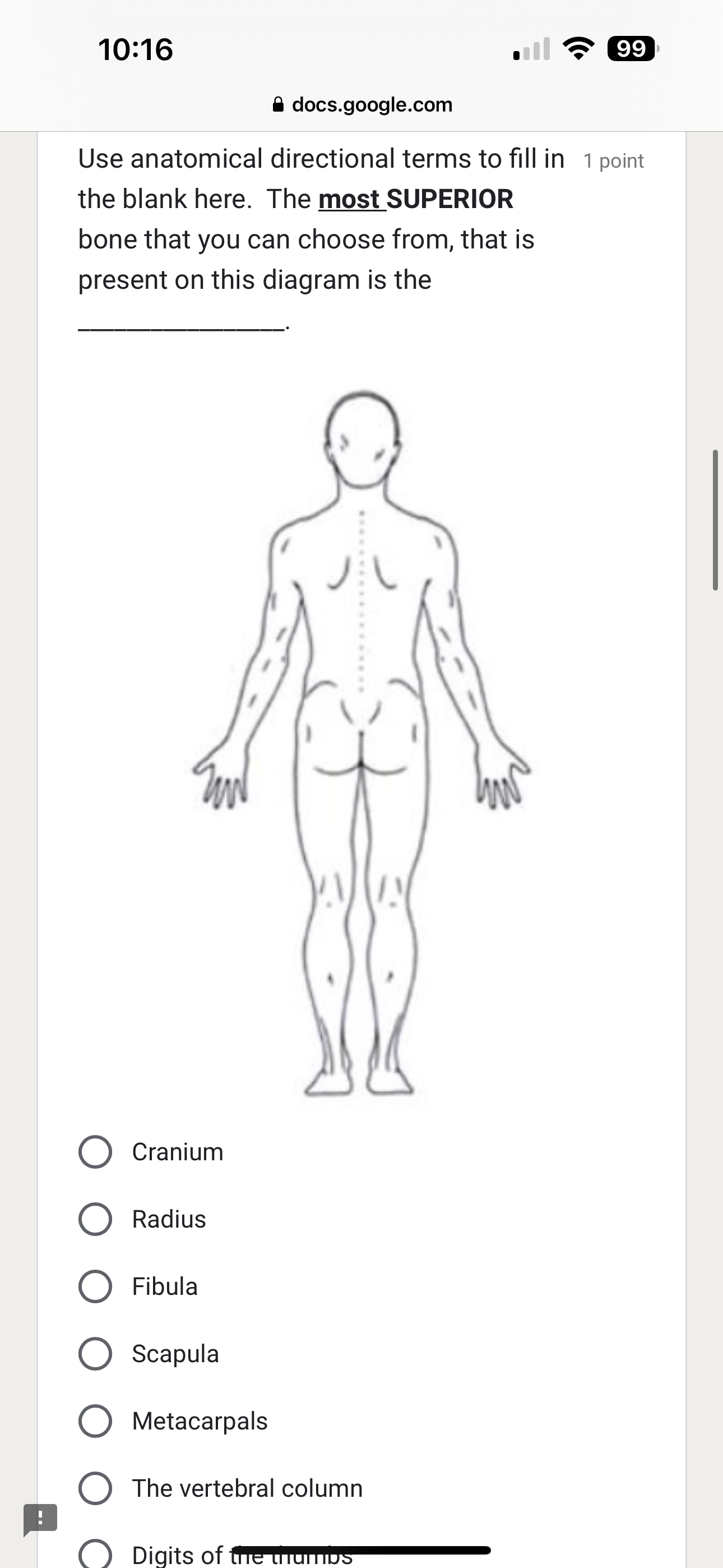 Solved 10:1699docs.google.comUse anatomical directional | Chegg.com