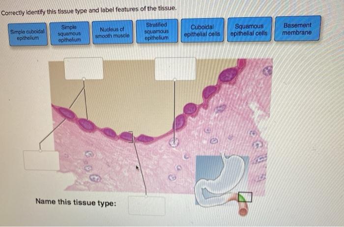 Solved Correctly identify this tissue type and label | Chegg.com
