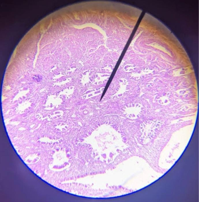 Solved Label and indicate Myometrium, Endometrium, Uterine | Chegg.com