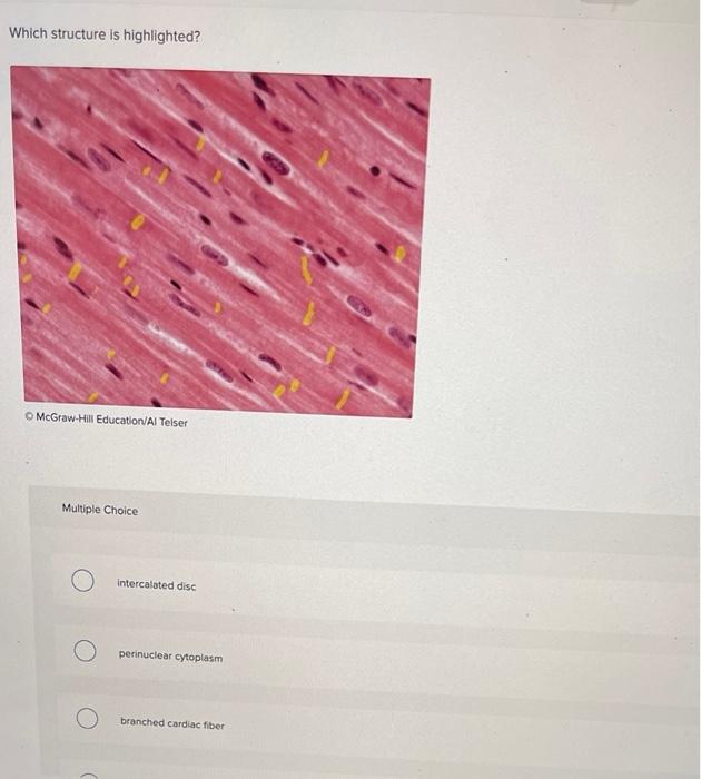 Which structure is highlighted? McGraw-Hill | Chegg.com