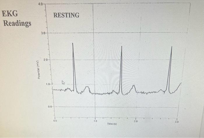 Solved In this activity, you will use the EKG three-second | Chegg.com