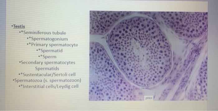 Solved Testis **Seminiferous tubule *Spermatogonium ** | Chegg.com