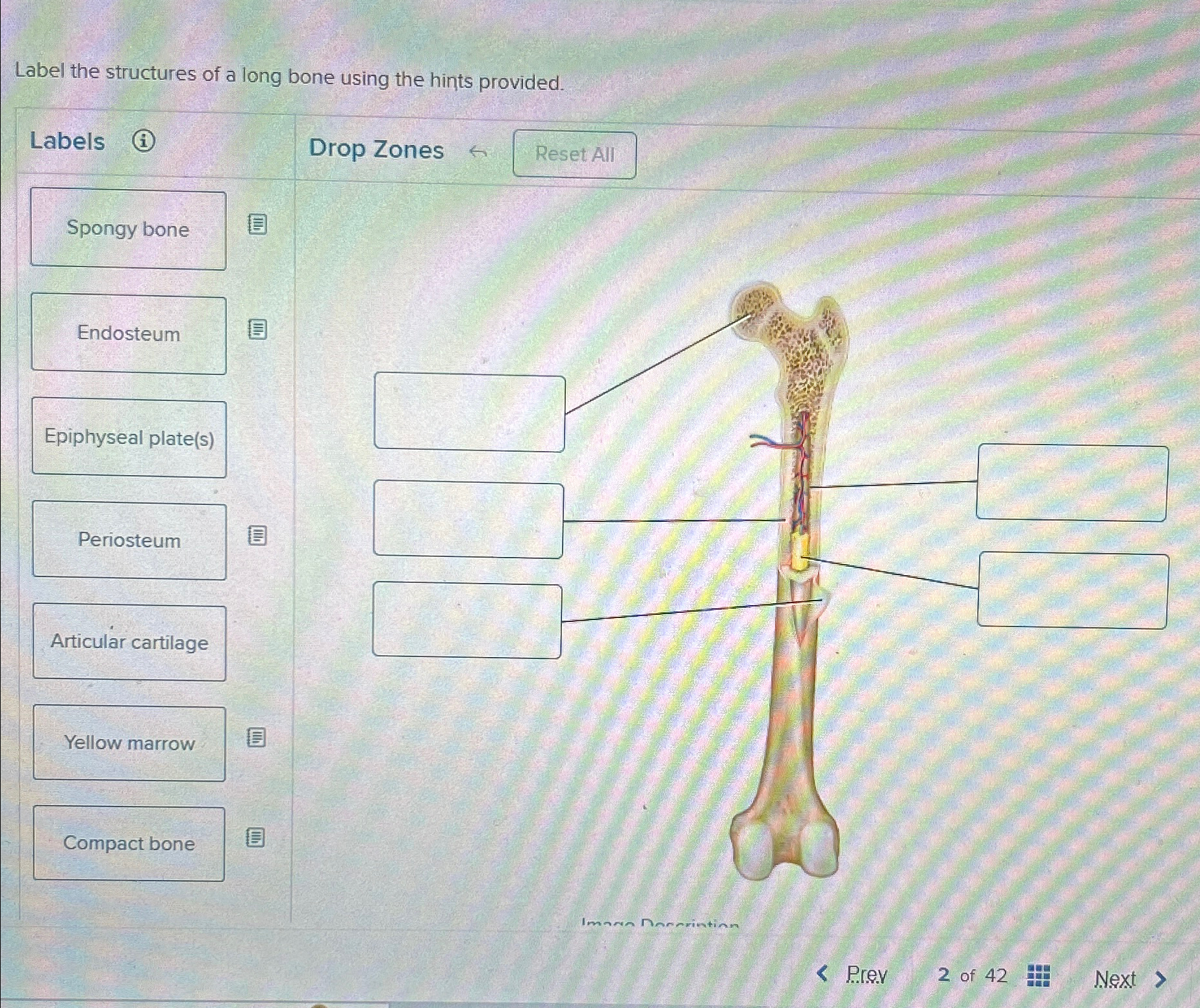 Solved Label the structures of a long bone using the hints | Chegg.com