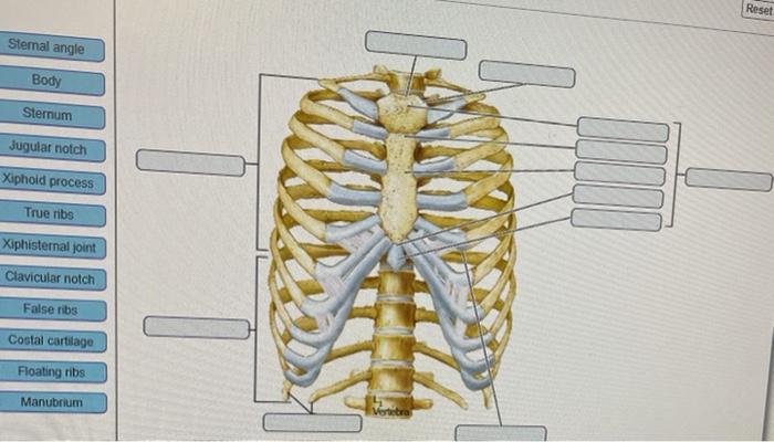 Solved Reset Stemal angle Body Sternum Jugular notch Xiphold | Chegg.com