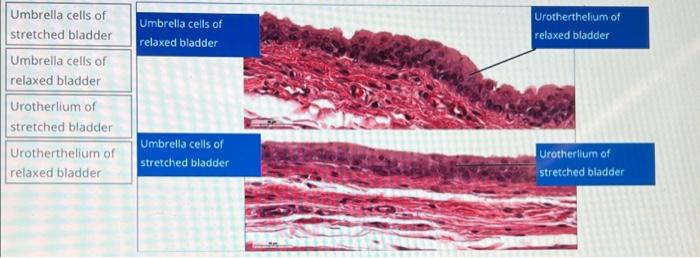 Solved Umbrella cells of relaxed bladder Urotherthelium of | Chegg.com