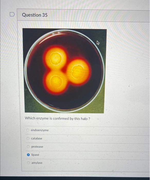 Solved Which enzyme is confirmed by this halo? endoenzyme | Chegg.com