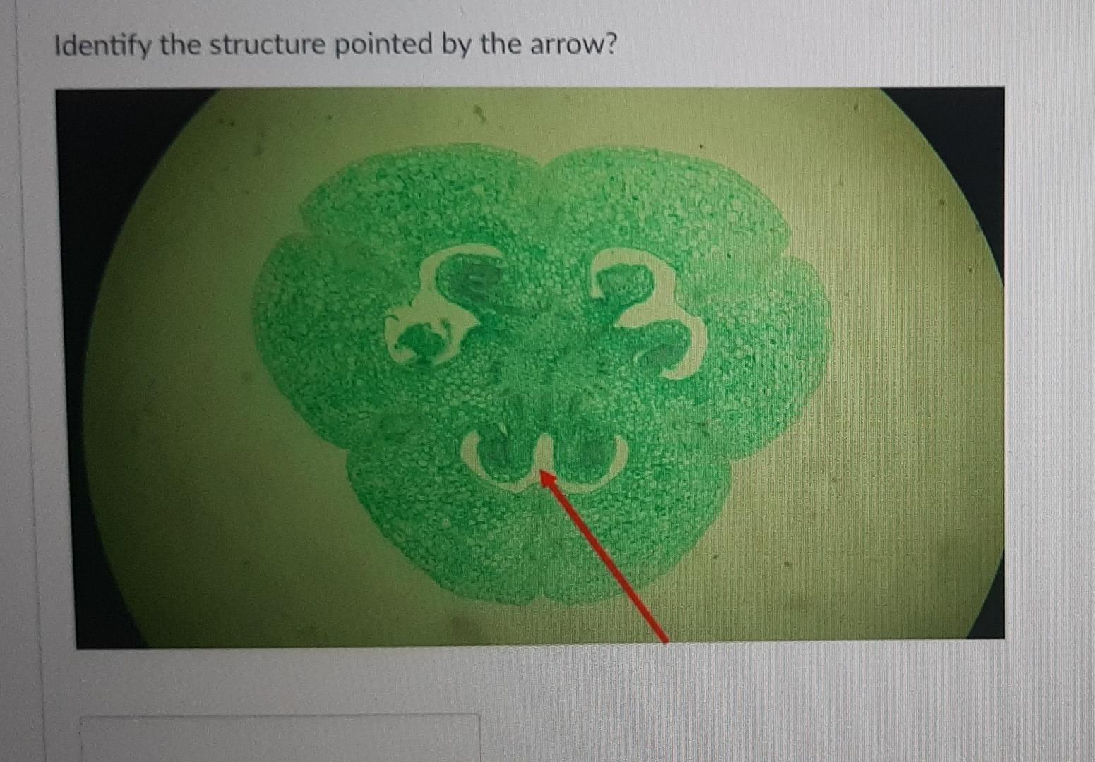 Solved Identify the structure pointed by the arrow? | Chegg.com