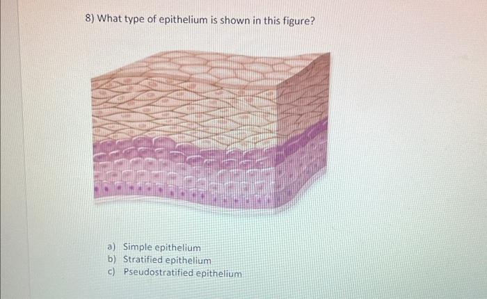 Solved 8) What type of epithelium is shown in this figure? | Chegg.com