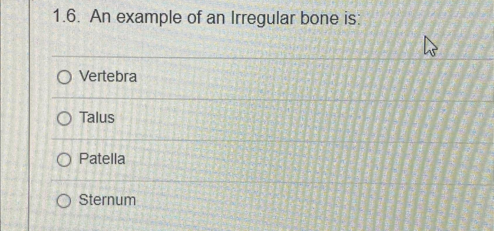 Solved 1.6. ﻿An example of an Irregular bone | Chegg.com