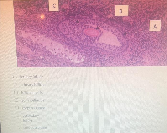 Solved tertiary follicle primary follicle follicular cells | Chegg.com