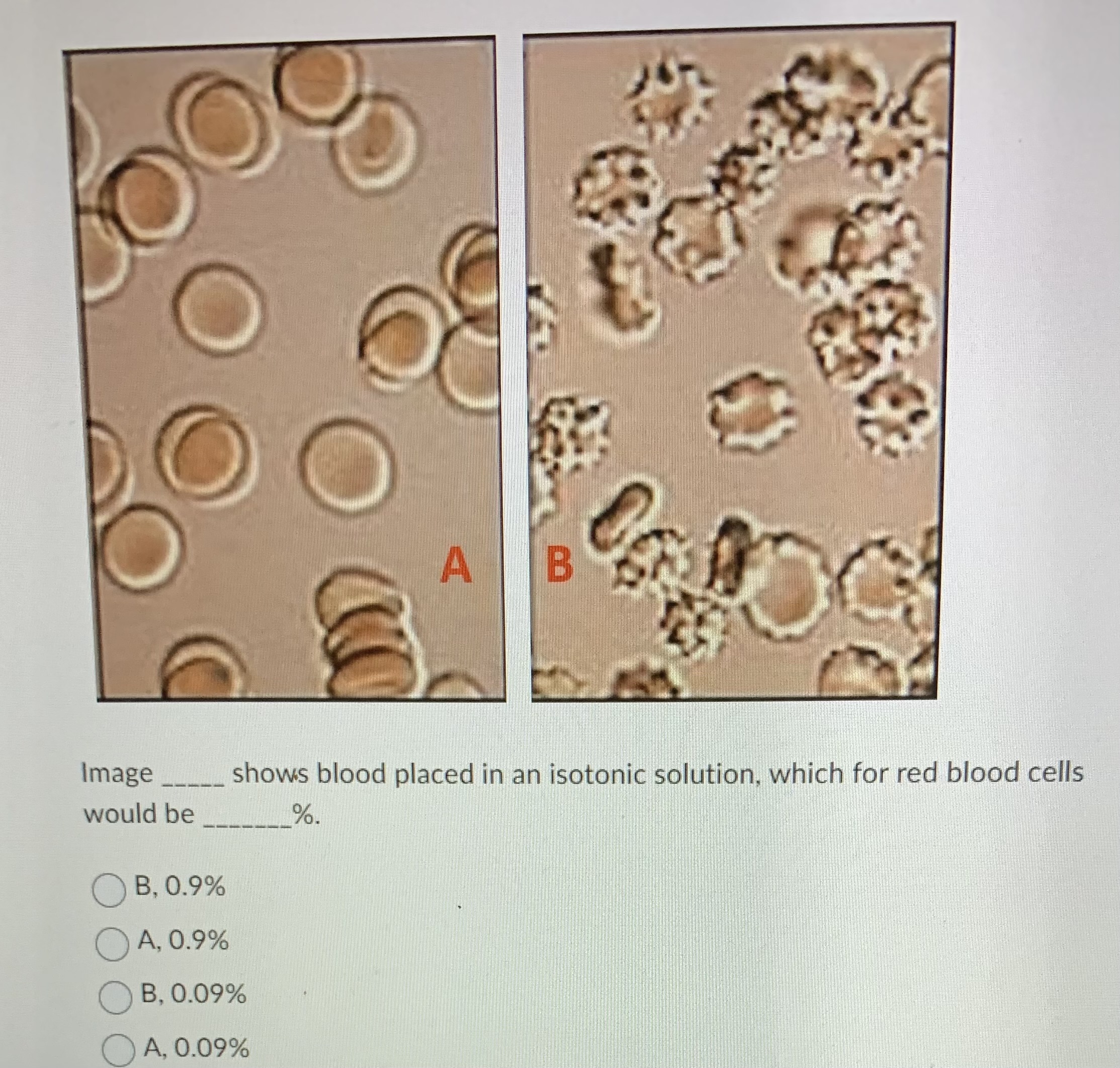Imageshows blood placed in an isotonic solution, | Chegg.com