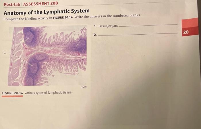 Solved Post-lab ASSESSMENT 20B Anatomy of the Lymphatic | Chegg.com