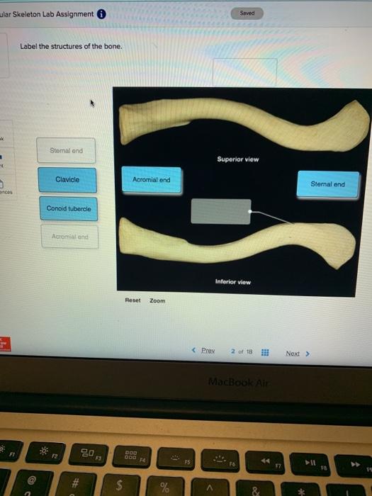 Solved ular Skeleton Lab Assignment Saved Label the | Chegg.com