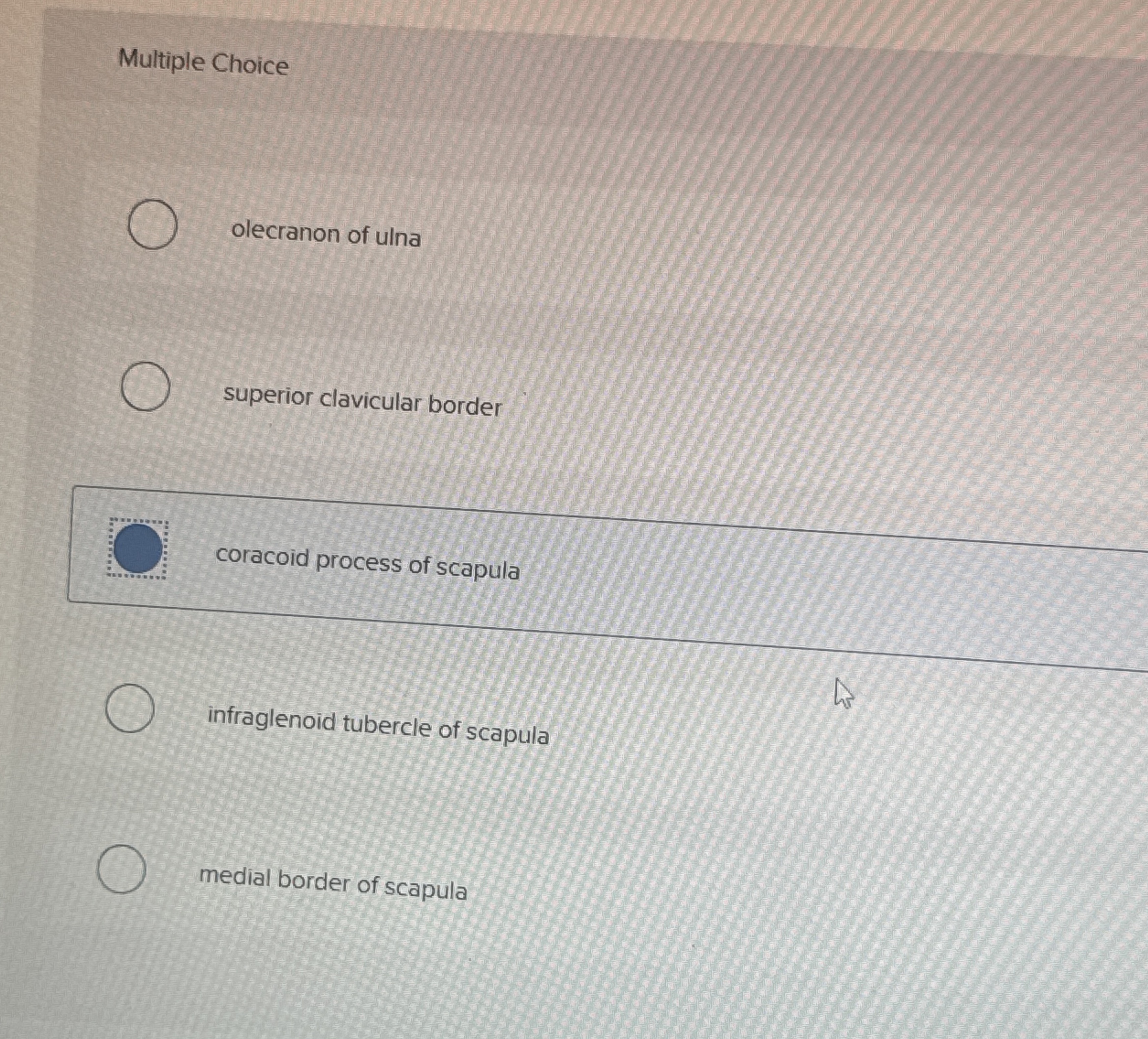 Solved What is the insertion Multiple Choiceolecranon of | Chegg.com