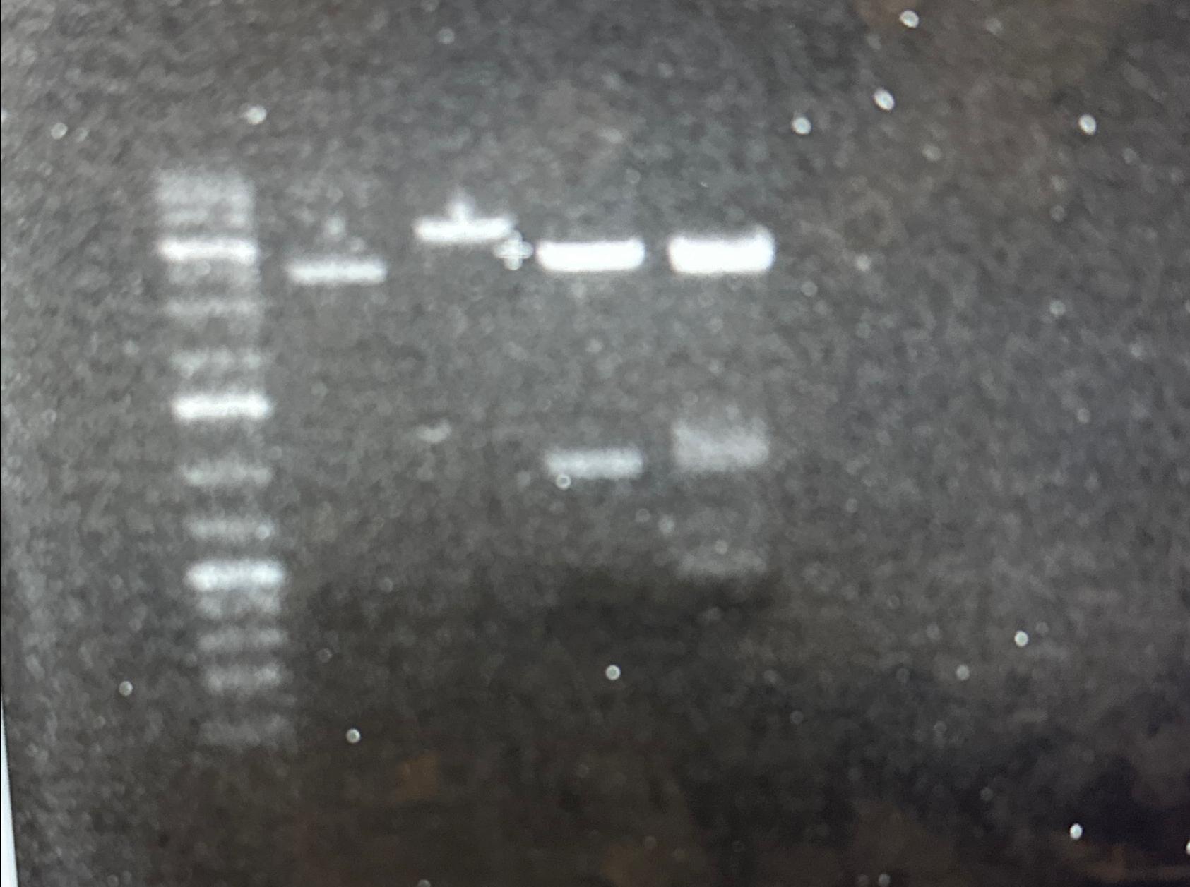 Solved Restriction Digest Lab Post Activity Bands: (Uncut | Chegg.com