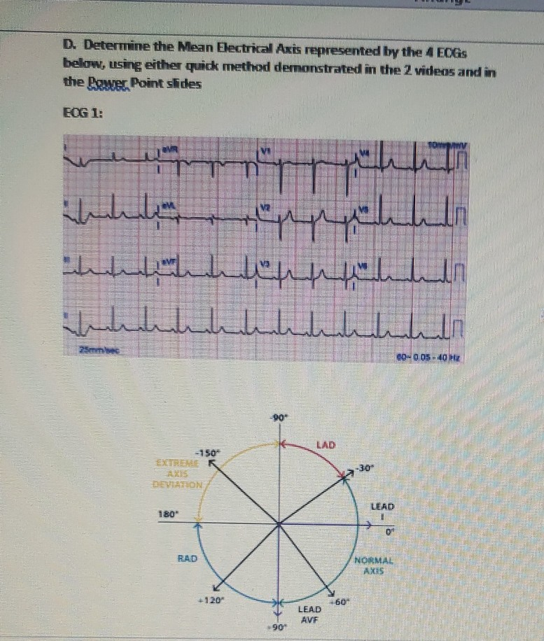 Solved D. Determine the Mean Electrical Axis represented by | Chegg.com