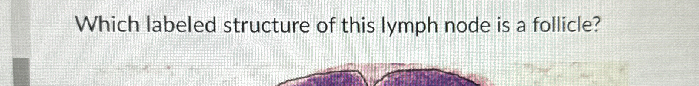 Solved Which labeled structure of this lymph node is a | Chegg.com