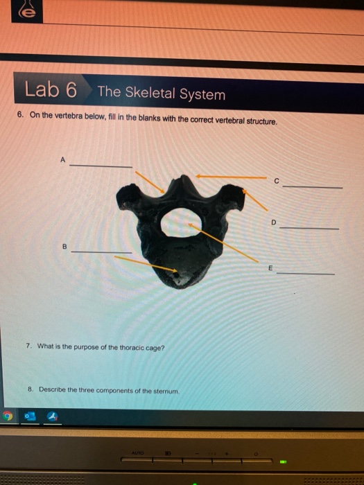 Solved e Lab 6 The Skeletal System 6. On the vertebra below, | Chegg.com