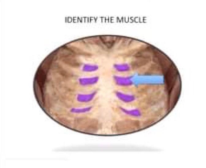 Solved IDENTIFY THE POINTED STRUCTURE. IDENTIFY THE | Chegg.com Solved IDENTIFY THE POINTED STRUCTURE. IDENTIFY THE | Chegg.com