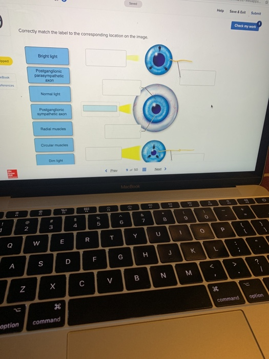 Solved Swed Help Save & Sub Check my w Correctly match the | Chegg.com