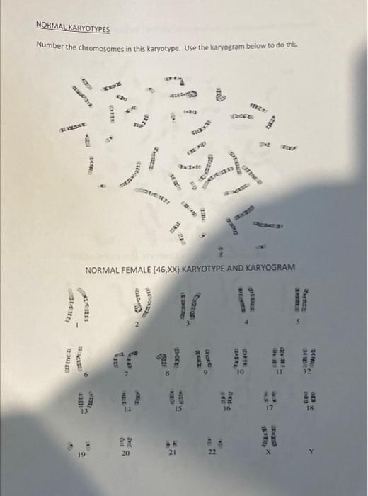 NORIMAL KARYOTYPES Number the chromosomes in this | Chegg.com