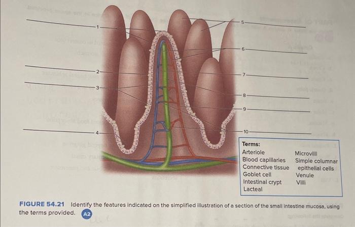 FIGURE 54.21 Identify the features indicated on the | Chegg.com