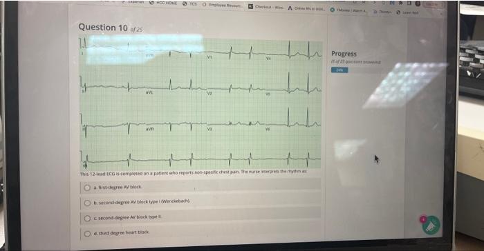 this 12 lead ecg is completed on a patient who | Chegg.com
