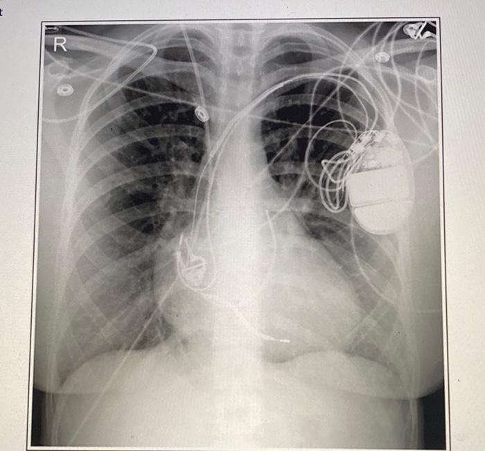 Solved list the essential projections for the entire | Chegg.com