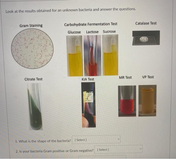Solved Look at the results obtained for an unknown bacteria | Chegg.com