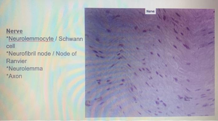 Solved Nerve Nerve *Neurolemmocyte/Schwann cell *Neurofibril | Chegg.com