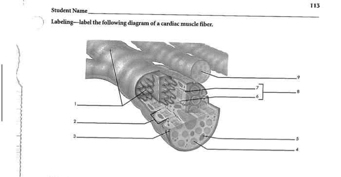 Solved Labeling - label the following diagram of a cardiac | Chegg.com