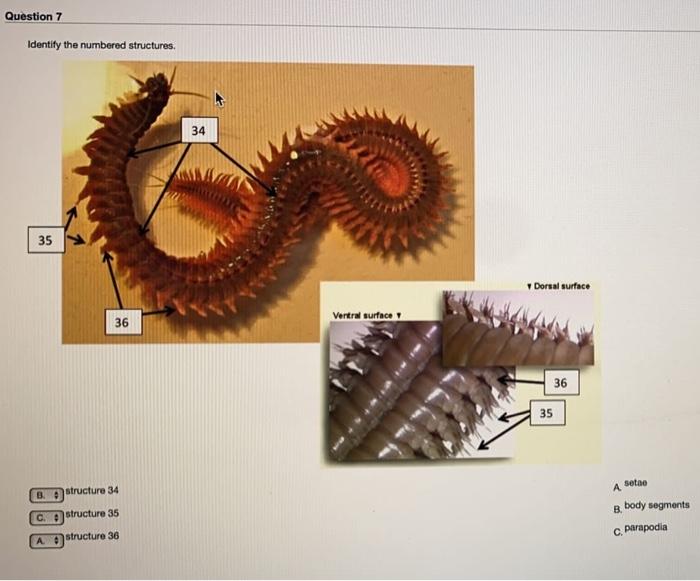 Solved Question 7 Identify the numbered structures, 34 35 | Chegg.com