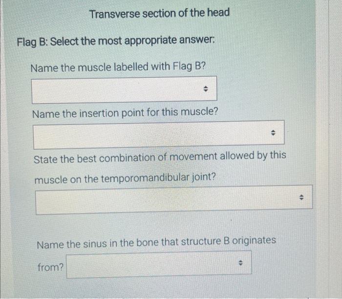 Solved Transverse section of the head Flag B: Select the | Chegg.com