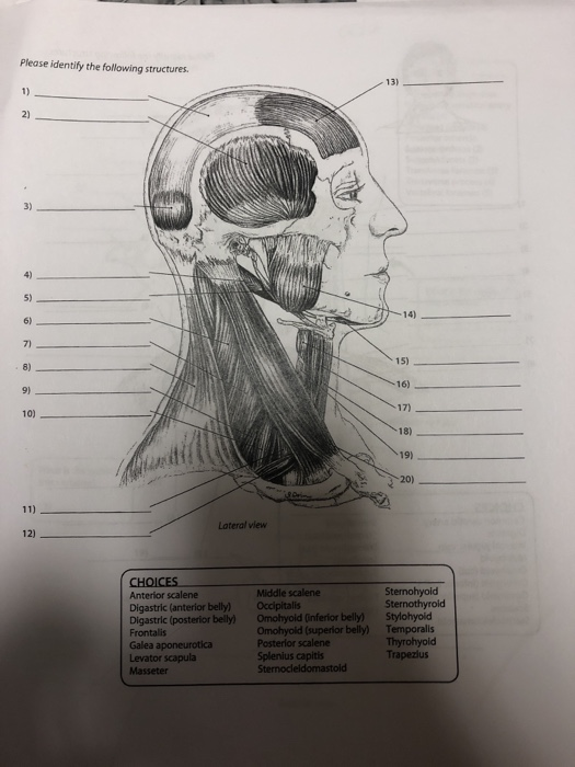 Solved Please identify the following structures. Lateral | Chegg.com