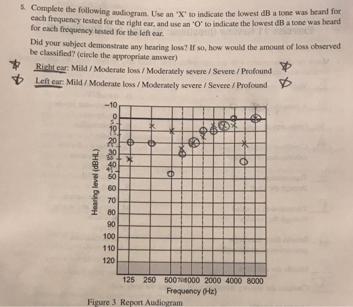 Solved 5. Complete the following audiogram. Use an 'X' to | Chegg.com