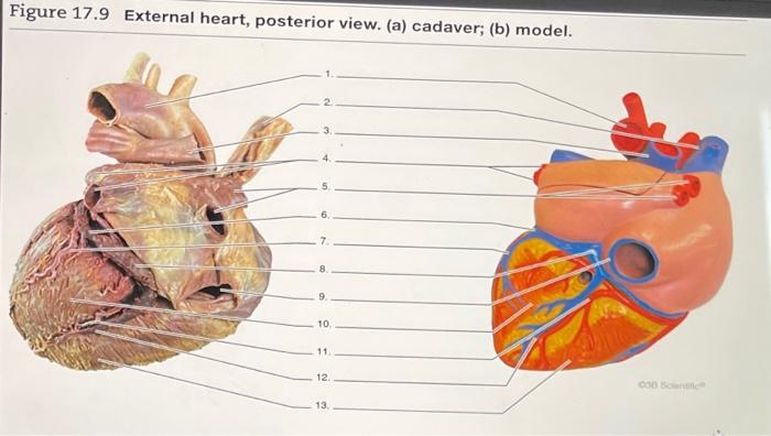 Solved Figure 17.9 External heart, posterior view. (a) | Chegg.com