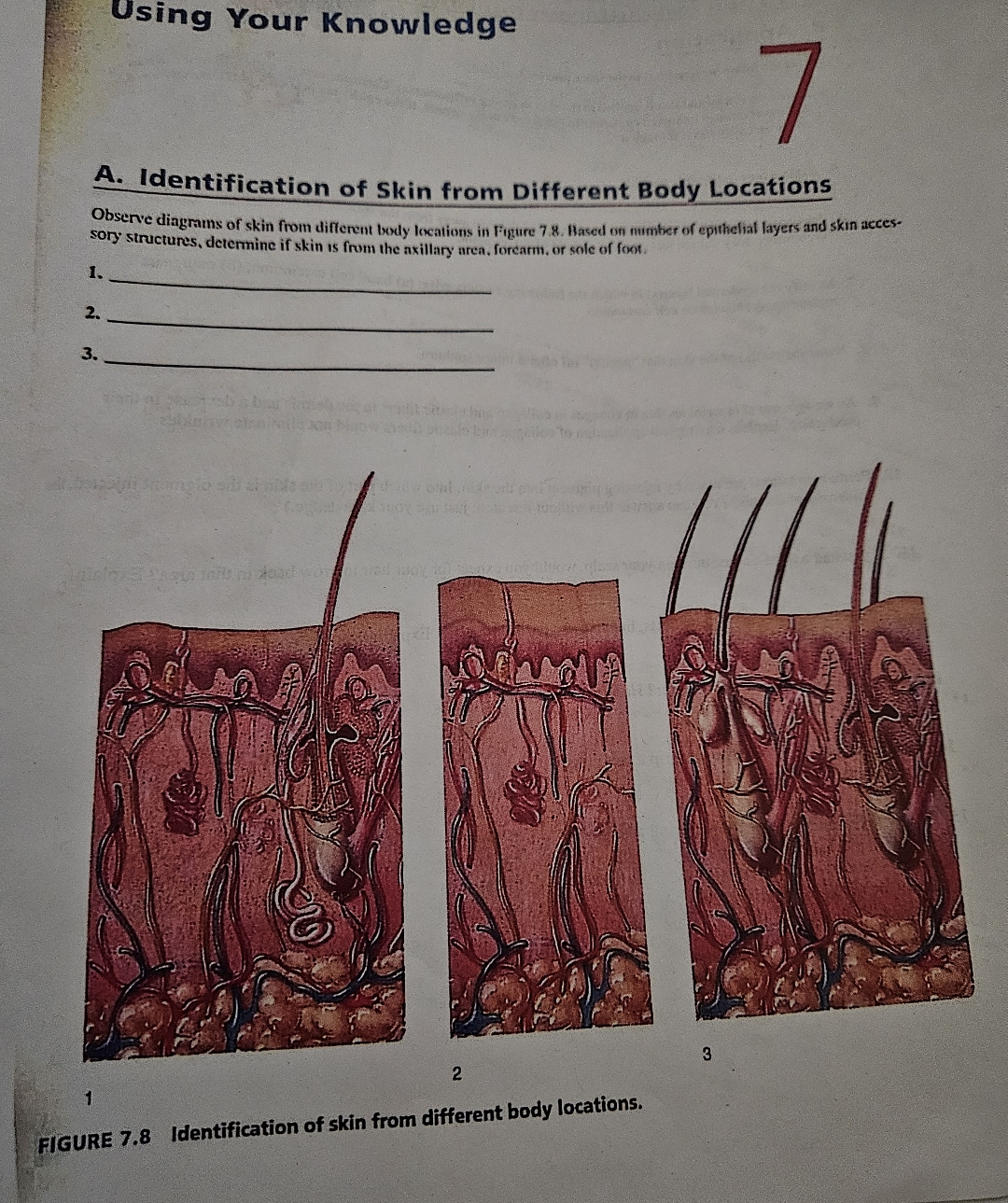 Solved Using Your KnowledgeA. ﻿Identification of Skin from | Chegg.com